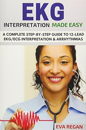 EKG: EKG Interpretation Made Easy: A Complete Step-By-Step Guide to 12 ...
