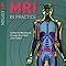 MRI in Practice: 9781444337433: Medicine & Health Science Books ...