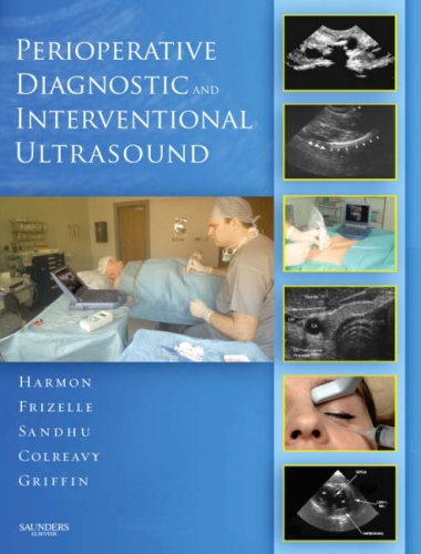 Perioperative Diagnostic and Interventional Ultrasound with DVD, 1e ...