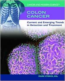 Colon Cancer: Current And Emerging Trends In Detection And Treatment ...