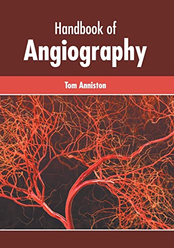 Handbook of Angiography: 9781639270729: Medicine & Health Science Books ...
