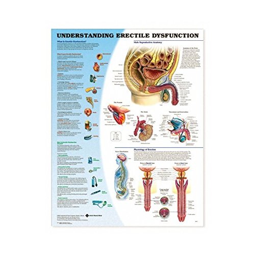 Amazon.com: Male Erectile Dysfunction EDS Chart: Industrial & Scientific