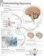Understanding Depression chart: Laminated Wall Chart: Scientific ...