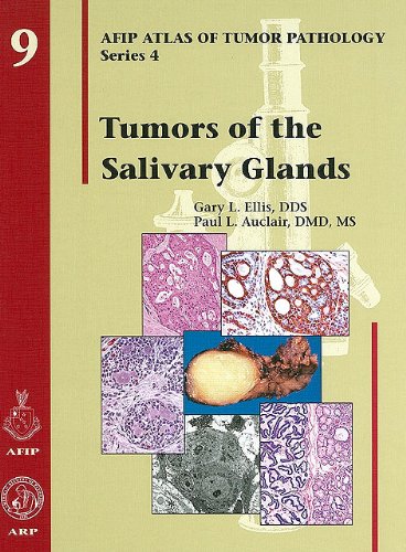 Tumors of the Salivary Glands (AFIP Atlas of Tumor Pathology: Series 4): 9780013644019: Medicine ...