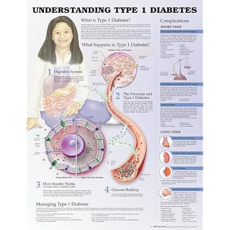 Mua Understanding Type 1 Diabetes Anatomical Chart trên Amazon Mỹ chính ...