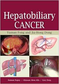 Hepatobiliary Cancer: 9781607950165: Medicine & Health Science Books ...