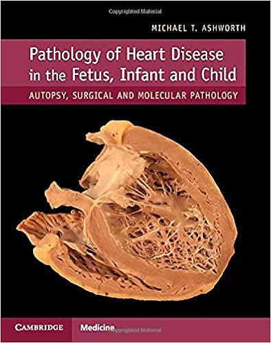Pathology Outlines - Heart & vascular pathology