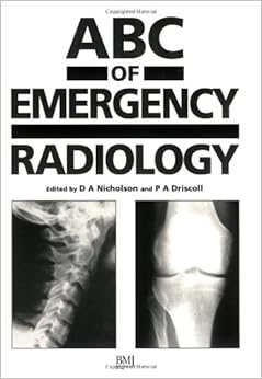 ABC of Emergency Radiology (ABC Series): 9780727908322: Medicine ...