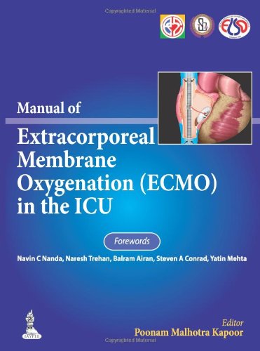 Manual of Extracorporeal Membrane Oxygenation Ecmo in the ICU ...