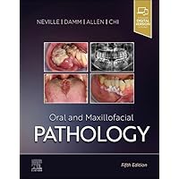 Oral and Maxillofacial Pathology: 9781455770526: Medicine & Health Science Books @ Amazon.com