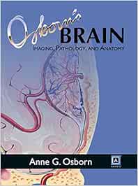 Osborn's Brain: Imaging, Pathology, and Anatomy: Osborn MD FACR, Anne G ...