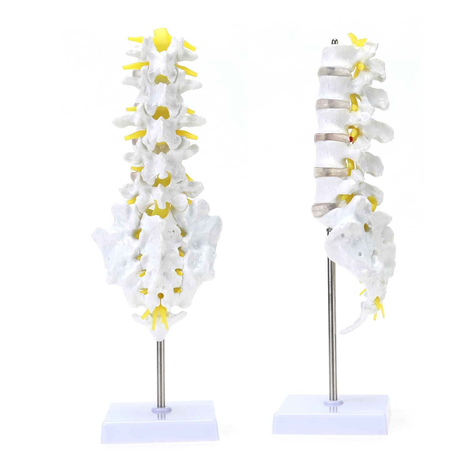 Mua Life Size Lumbar Spine Anatomical Model with A Herniated Disc at L4 ...