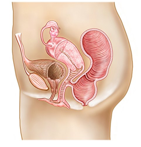 Buy Rectovaginal Fistula And Cross Section Of Female Reproductive buy-rectovaginal-fistula-and-cross-section-of-female-reproductive