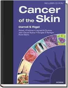 Cancer of the Skin: Text with CD-ROM: 9780721605449: Medicine & Health ...