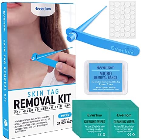 Micro Skin Tag Remover- Fast and Easy Skin Tag Remover- Painless Skin ...