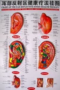 Amazon.com: Chart of The Ear Reflection Zones Health Therapy(with ...