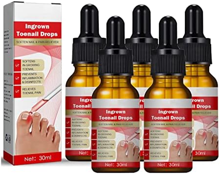 NHINA Nail Helper Ingrown Toenail Drops, Best Ingrown Toenail Treatment ...