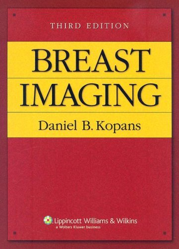 Breast Imaging (Kopans, Breast Imaging): 9780781747684: Medicine ...