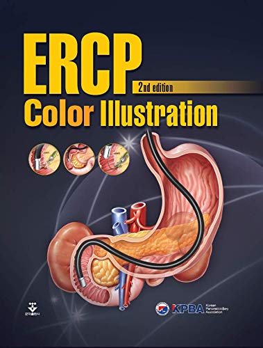 ERCP Color Illustration, 2nd Edition: Korean Pancreatobiliary ...