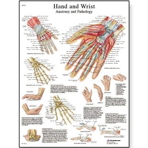 Buy 3B Scientific Human Anatomy - Hand and Wrist Anatomy/Pathology ...