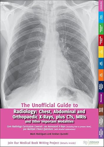 Unofficial Guide to Radiology: Chest, Abdominal and Orthopaedic X Rays ...
