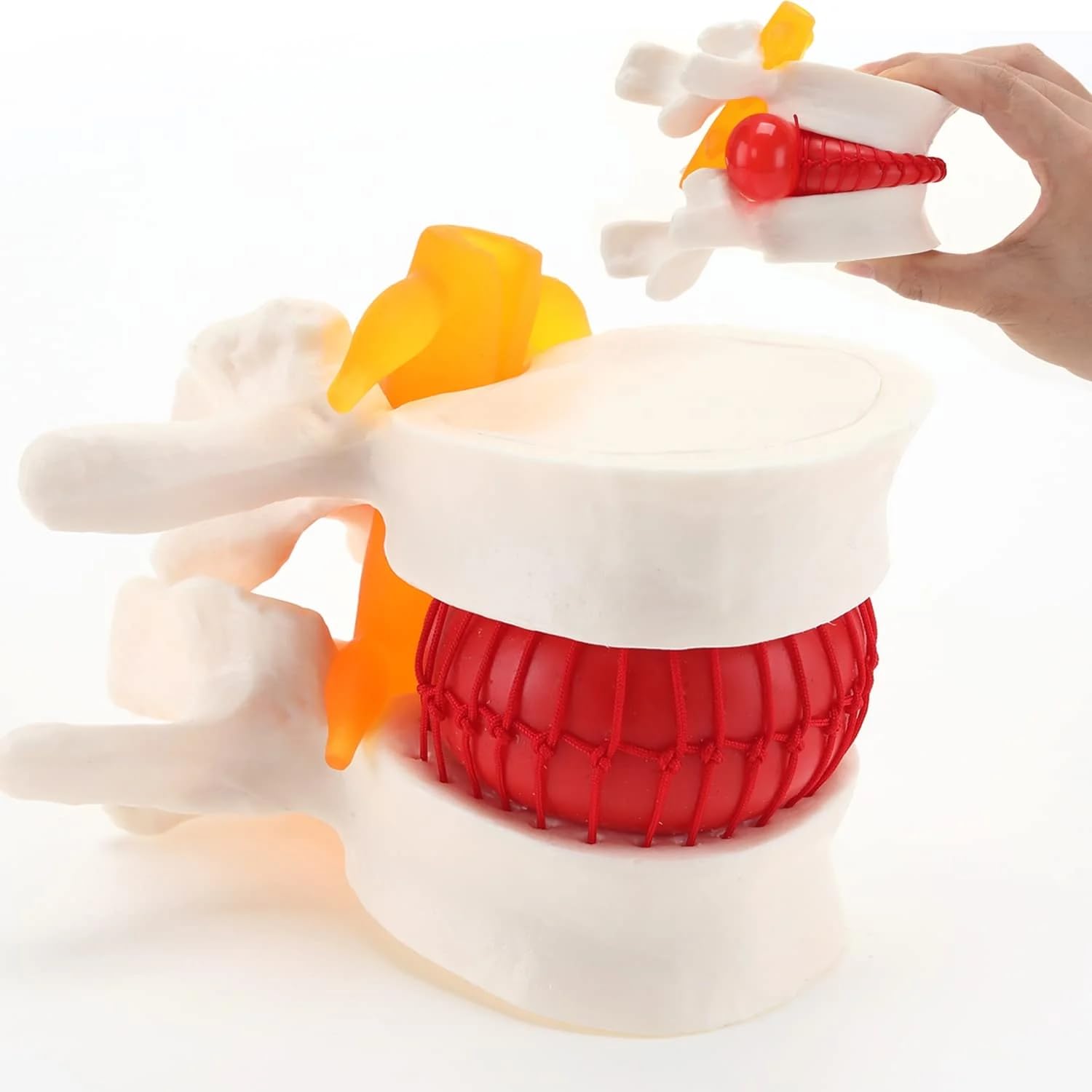 Mua Human Anatomical Lumbar Disc Herniation Model - Lumbar Spine Model ...