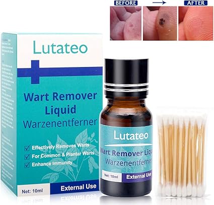 Contre les verrues, Cryopharma, Wartner,élimination des verrues ...