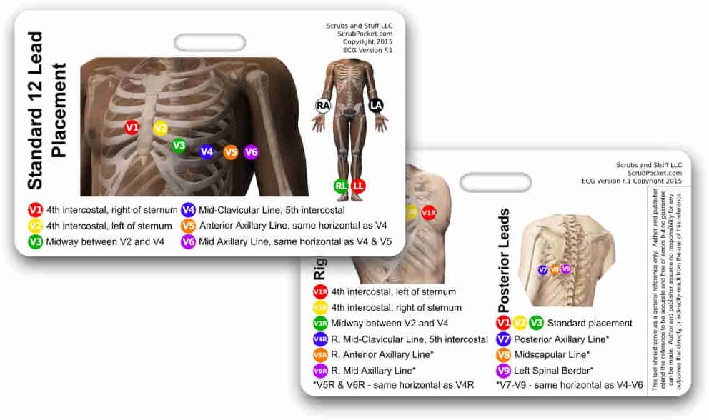 12 Lead Ekg Placements Colors | Images and Photos finder