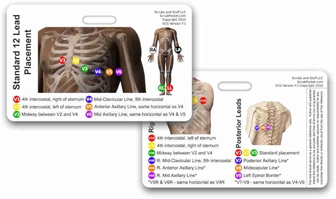 Amazon.com: 12 Lead EKG Placement Horizontal Badge Reference Card (1 ...