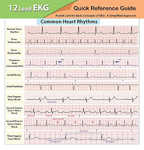 EKG Pocket Card in Dubai - UAE | Whizz Subjects