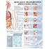 Amazon.com: Sexually Transmitted Disease (STD) Facts Poster Laminated 22" x 29": Prints: Posters ...