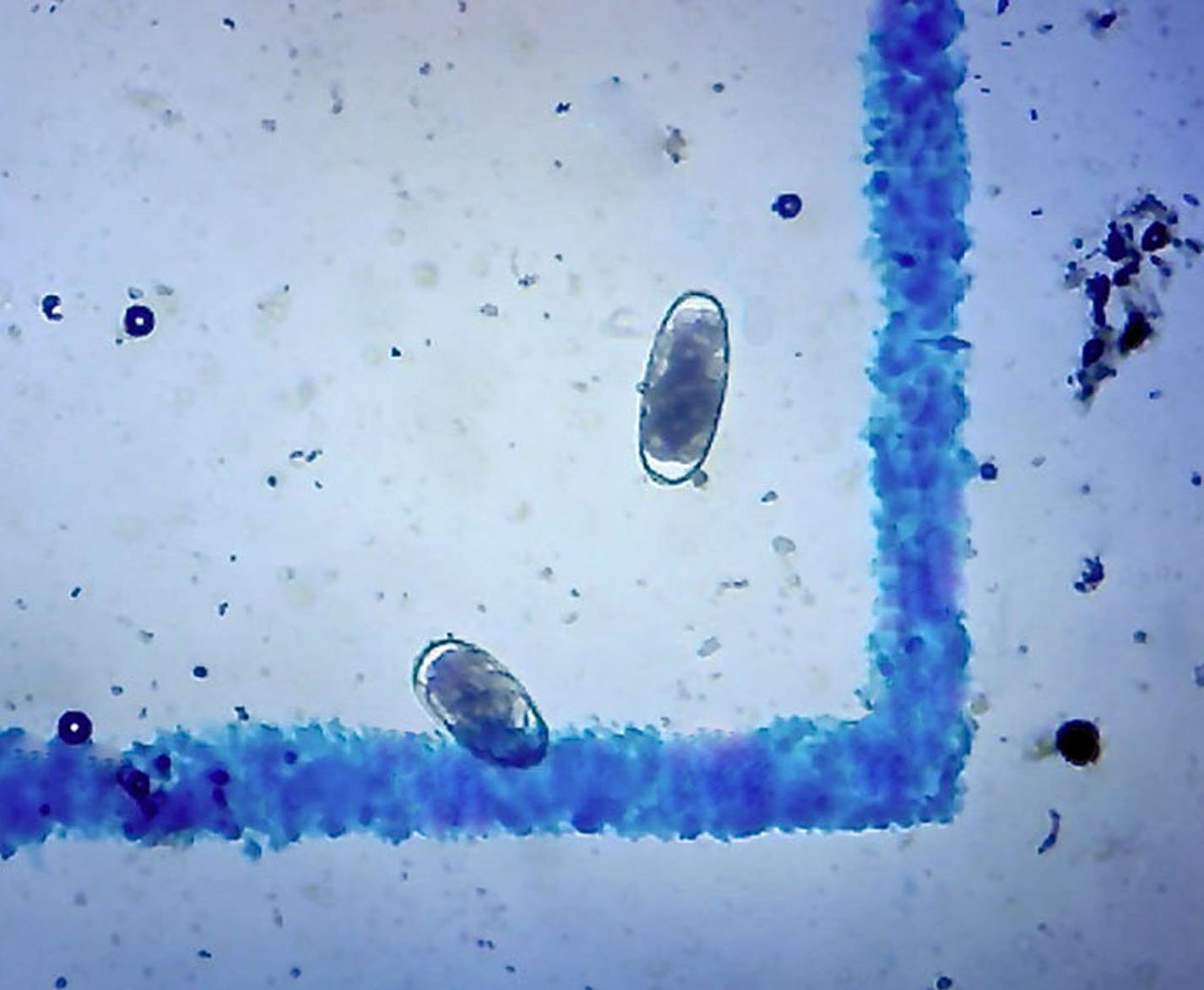 Mua Fecal Egg Count Supply - McMaster Method, by FEC Source. Fecal/Worm ...