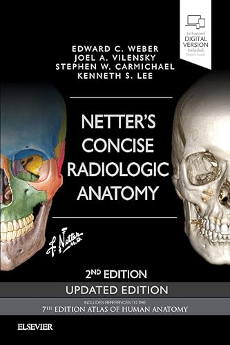 Netter's Concise Radiologic Anatomy Updated Edition (Netter Basic ...