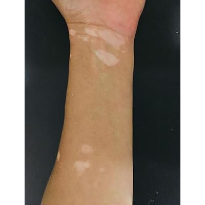 Crème Pseudocatalase - 100g, pour Soins & Maroc | Ubuy