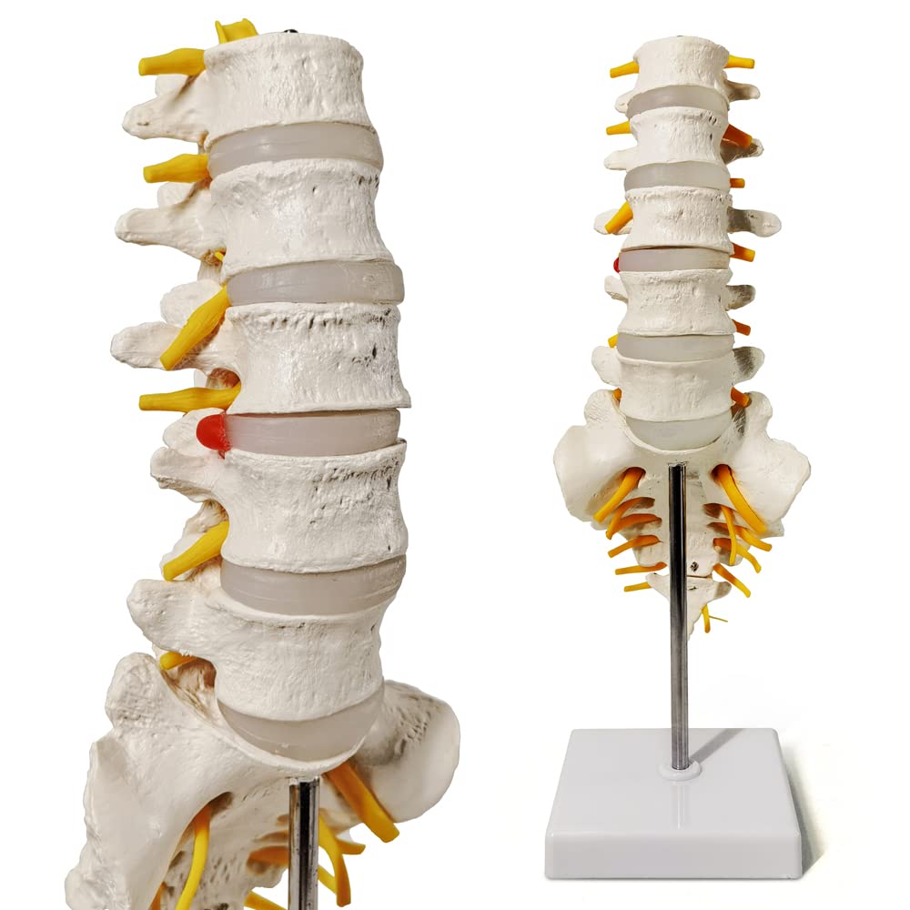 Mua Evotech Lumbar Spine Anatomy Model with Sacrum and Spinal Nerves ...