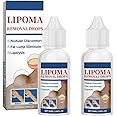Amazon.com: Herbal Lipoma Removal Drops,Lipoma Removal,Lipoma Removal ...