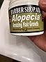 Amazon.com : Alopecia Amazing Hair Growth : Hair Growth Products ...