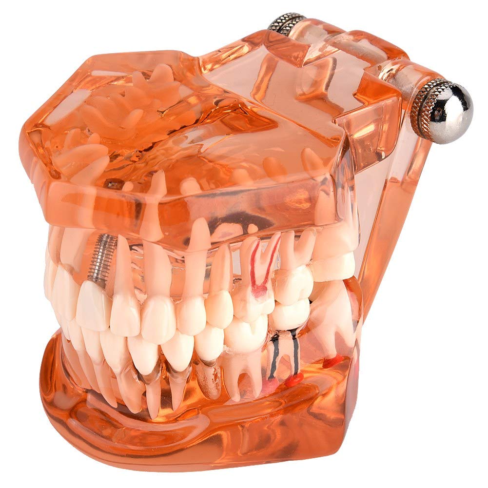 Mua teeth, tooth model, orange, dental disease, removable ...