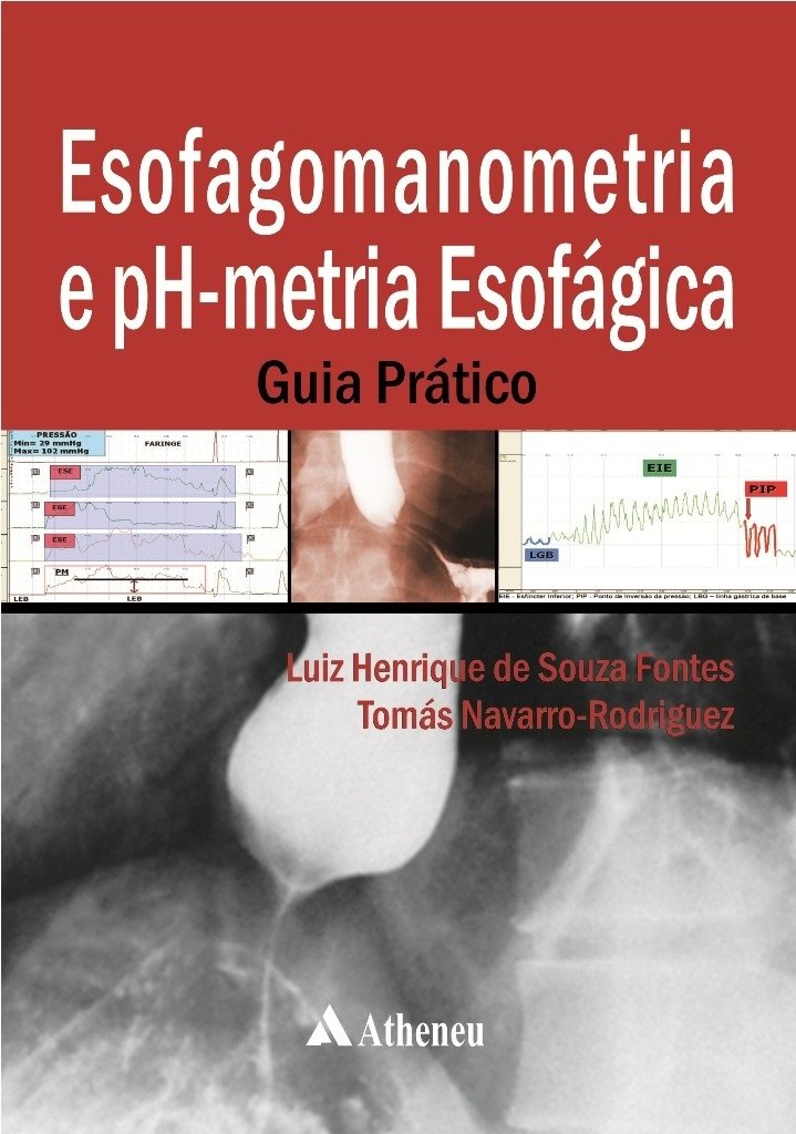 Esofagomanometria e PH-metria Esofágica. Guia Prático PDF Luiz Henrique ...