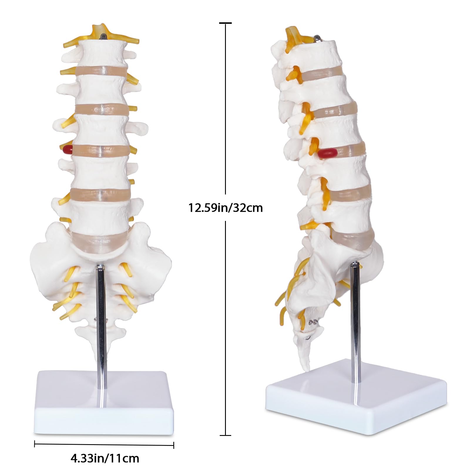 Mua NLShan Scientific Lumbar Spine Model with 5 Vertebrae, Life Size ...