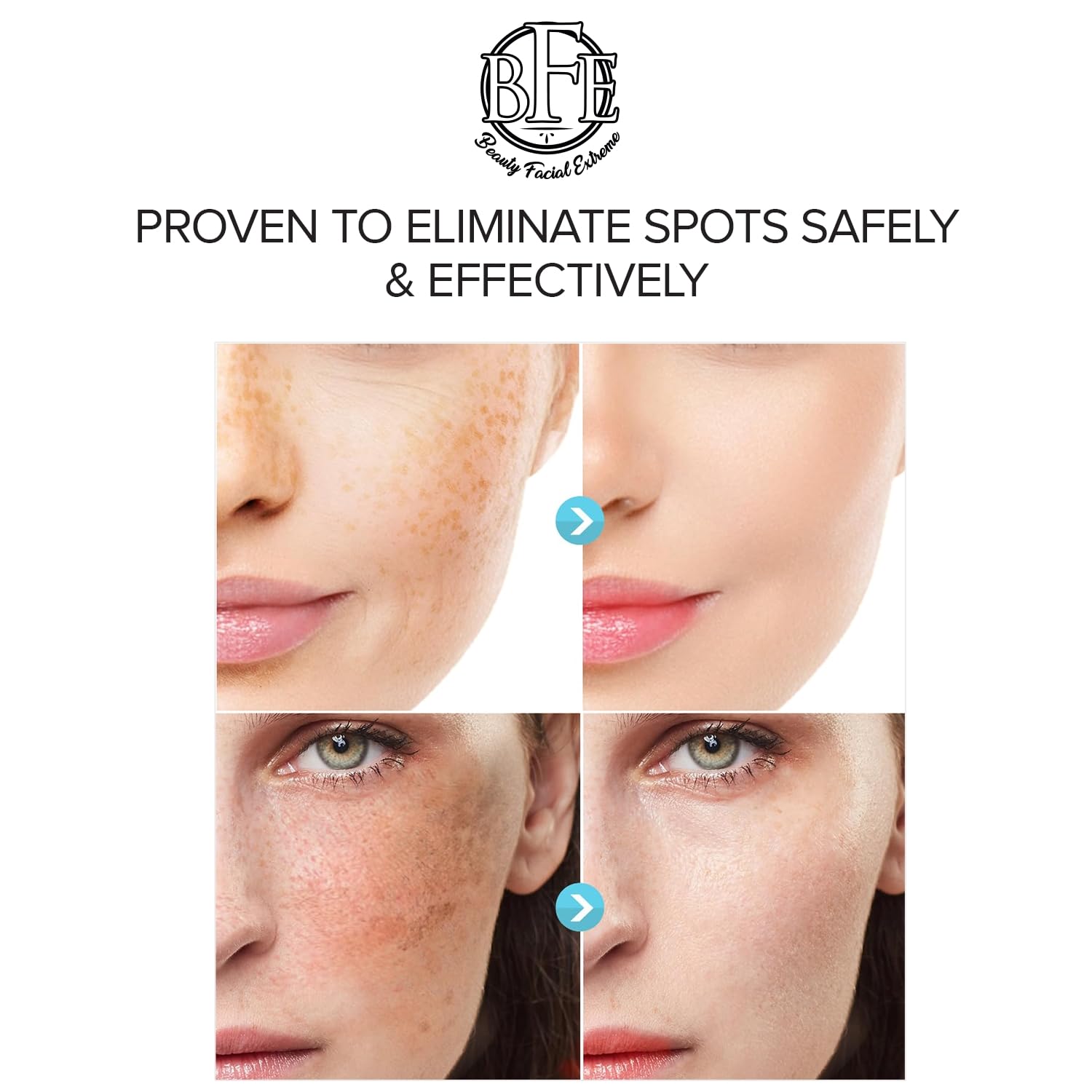 Mua Beauty Facial Extreme Dark Spot Corrector Cream- Visibly Fades ...