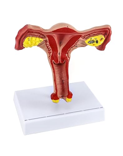 QWORK Human Female Uterus and Ovary Model, Female Genital Organ ...