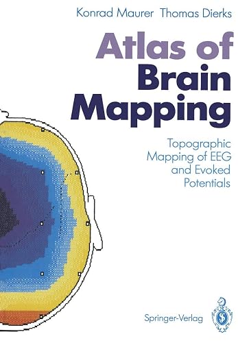 Atlas of Brain Mapping: Topographic Mapping of EEG and Evoked ...