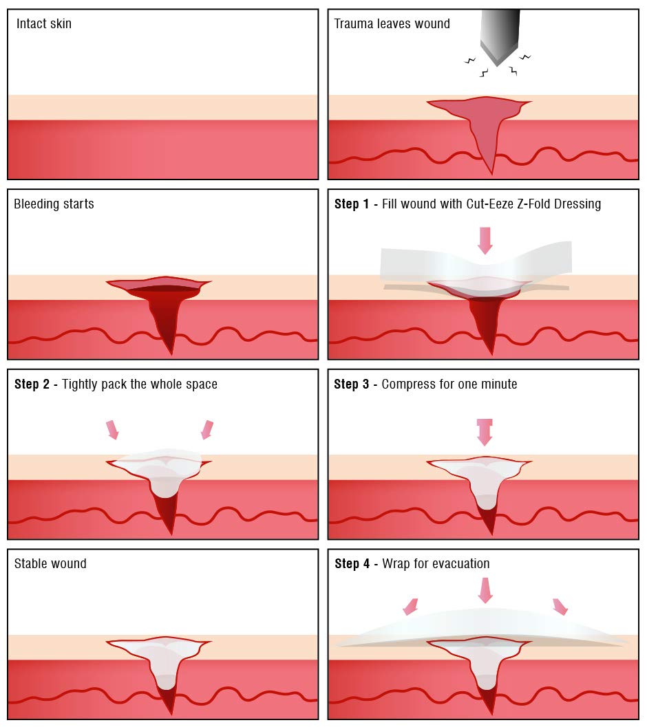 CUT-EEZE CM0565 Haemostatic Spray, Click Medical, 70 mL - BigaMart