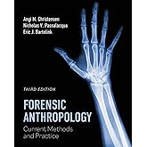 Forensic Anthropology: Current Methods and Practice: 9780128157343: Medicine & Health Science ...