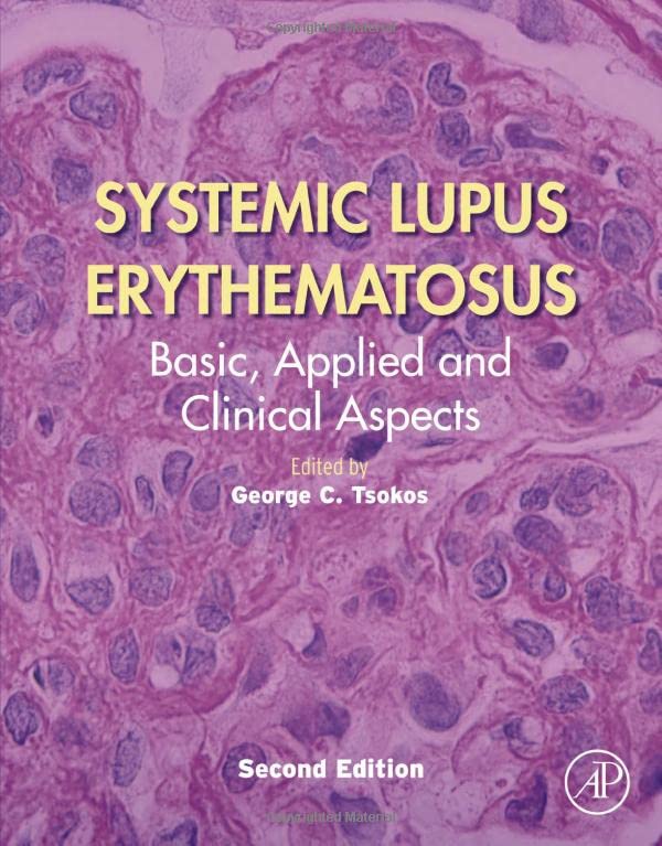 Systemic Lupus Erythematosus: Basic, Applied and Clinical Aspects ...