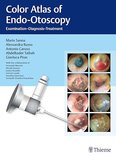 Color Atlas of Endo-Otoscopy: Examination - Diagnosis - Treatment in ...