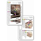 Amazon.com: 12 Lead EKG Placement Horizontal Badge Reference Card (1 Card) : Office Products