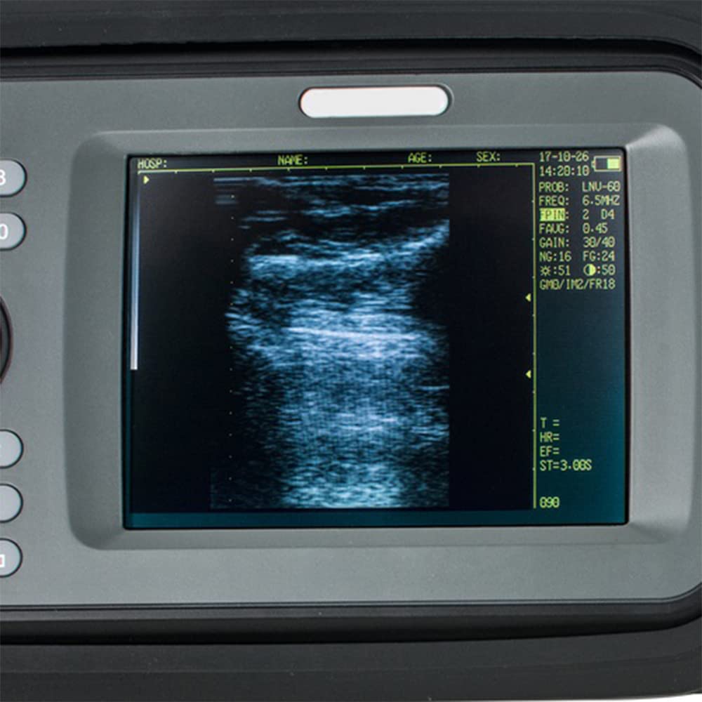 Mua Colilove Veterinary Ultrasound Scanner Handheld Digital Ultrasound ...