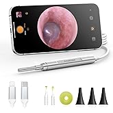 Amazon.com: VSATEN USB Otoscope, Digital Ear Camera 720HD Ear Scope ...